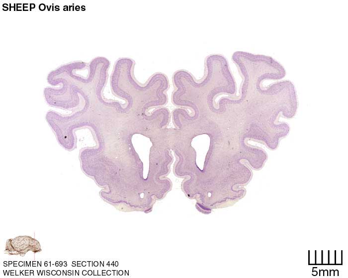 Atlas of the Sheep Brain > Section Image