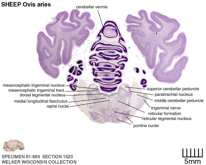 Trigeminal Nerve Sheep Brain Cranial Nerves | Veterian Key